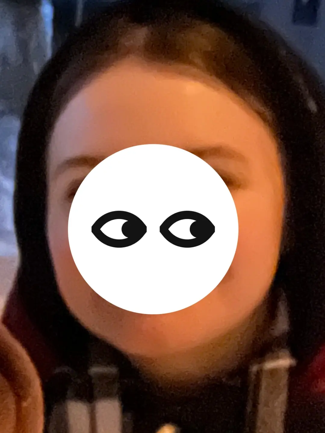 Before After Transformation - -6,5 kg (14,3 Ibs) face changes